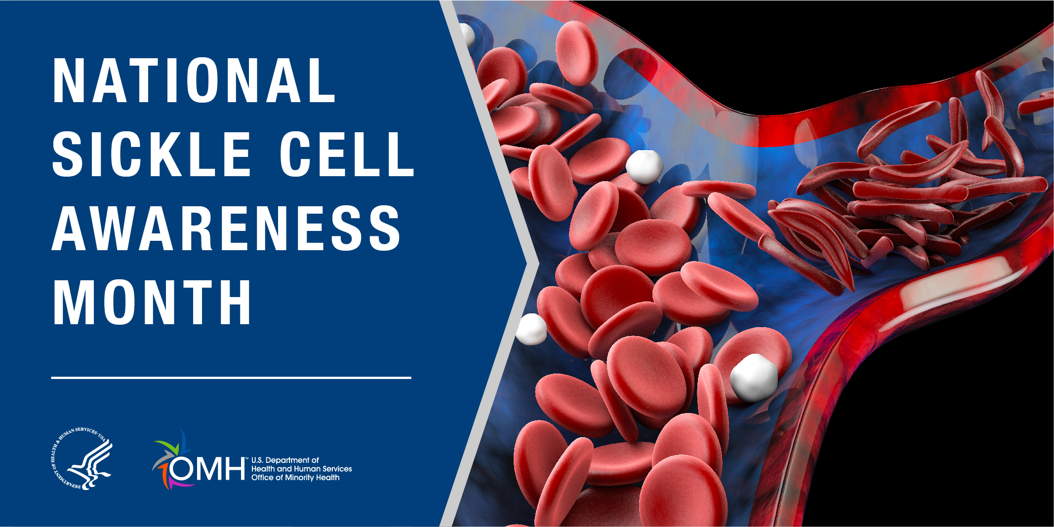 September is National Sickle Cell Awareness Month - 16th Street Baptist ...